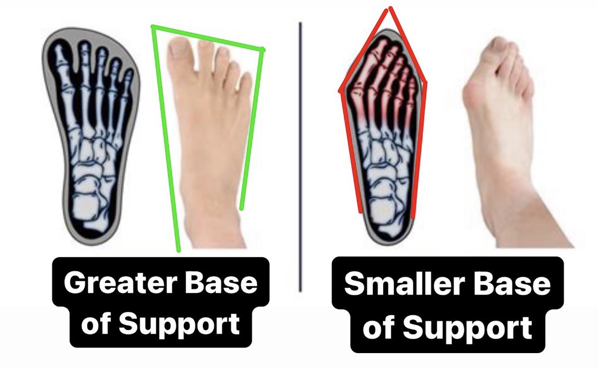 I guarantee the shoes you’re wearing are damaging your health Modern ...