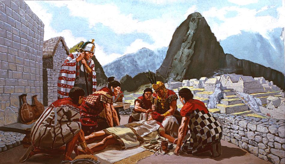 Inca Trepanation
