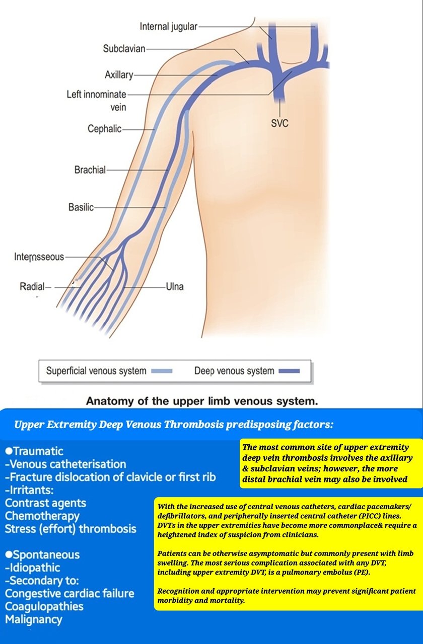 Venous Anatomy Upper Extremity The Superficial Veins Of The Upper Limb