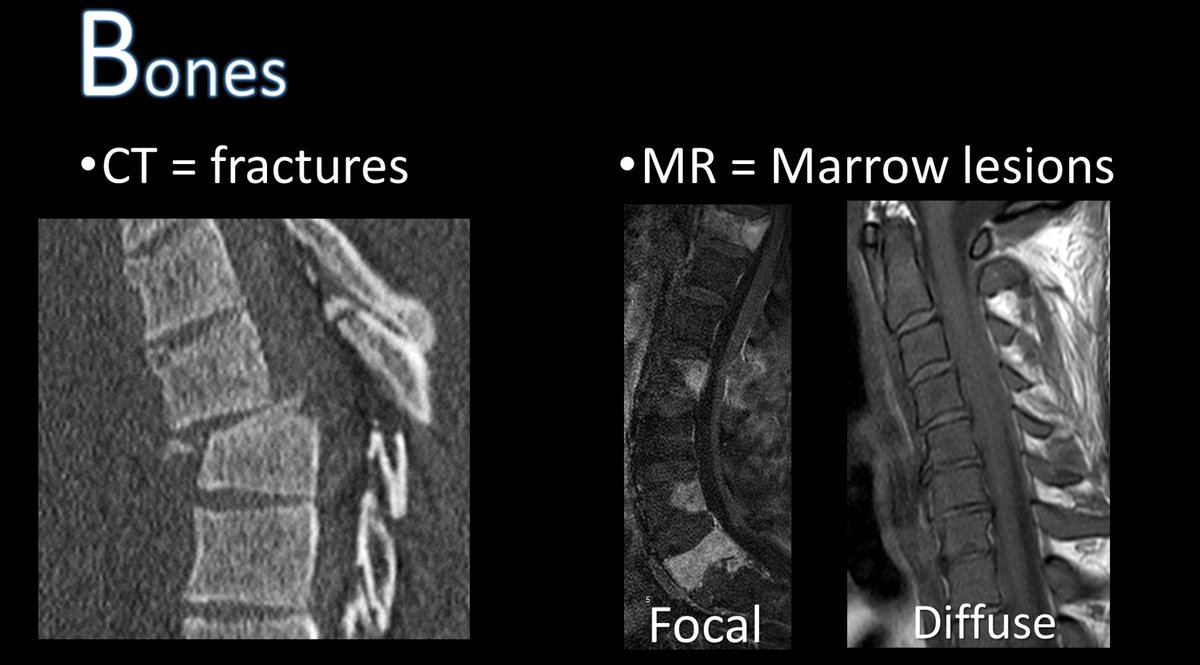 1/Need help reading spine imaging? I’ve got your back! It’s as easy as ...