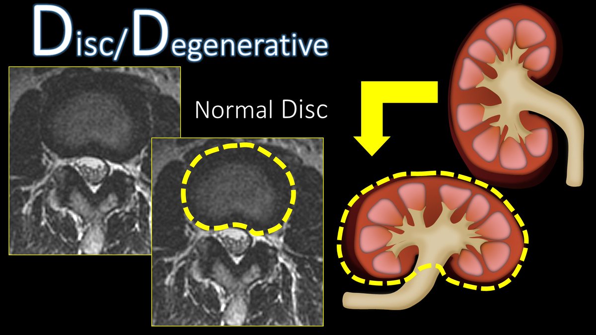 1/Need help reading spine imaging? I’ve got your back! It’s as easy as ...