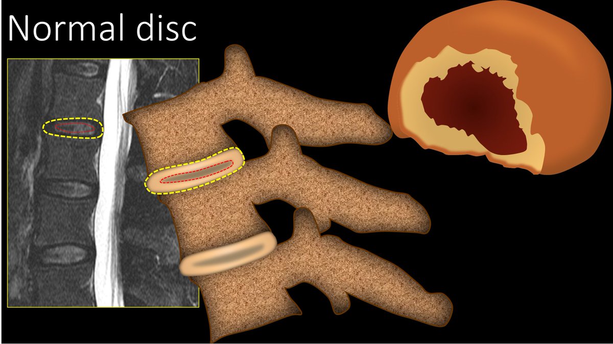1/Need help reading spine imaging? I’ve got your back! It’s as easy as ...