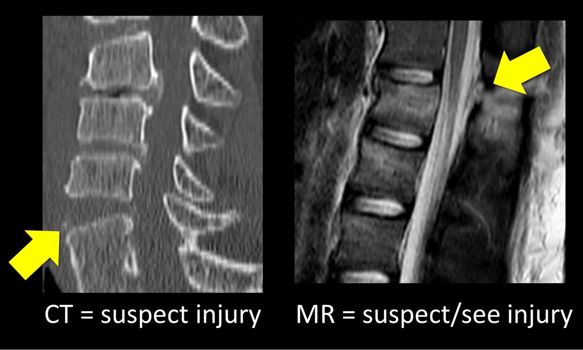 1/Need help reading spine imaging? I’ve got your back! It’s as easy as ...
