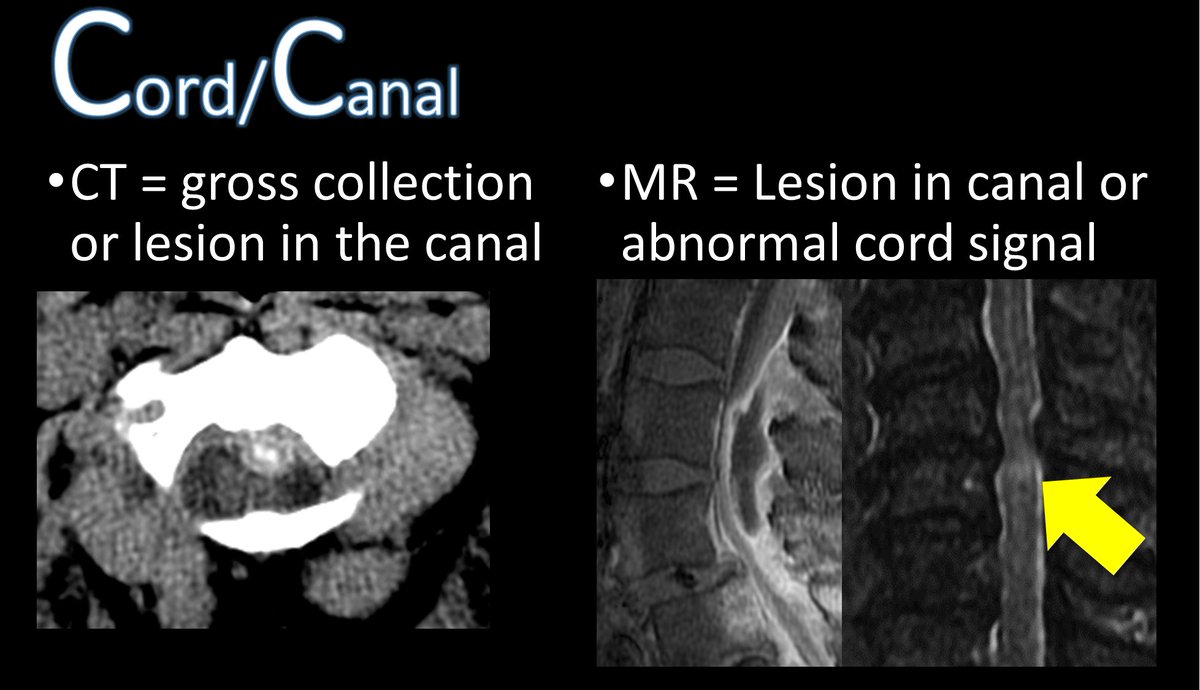 1/Need help reading spine imaging? I’ve got your back! It’s as easy as ...