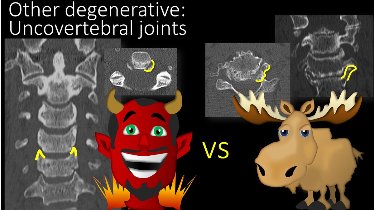 1/Need help reading spine imaging? I’ve got your back! It’s as easy as ...