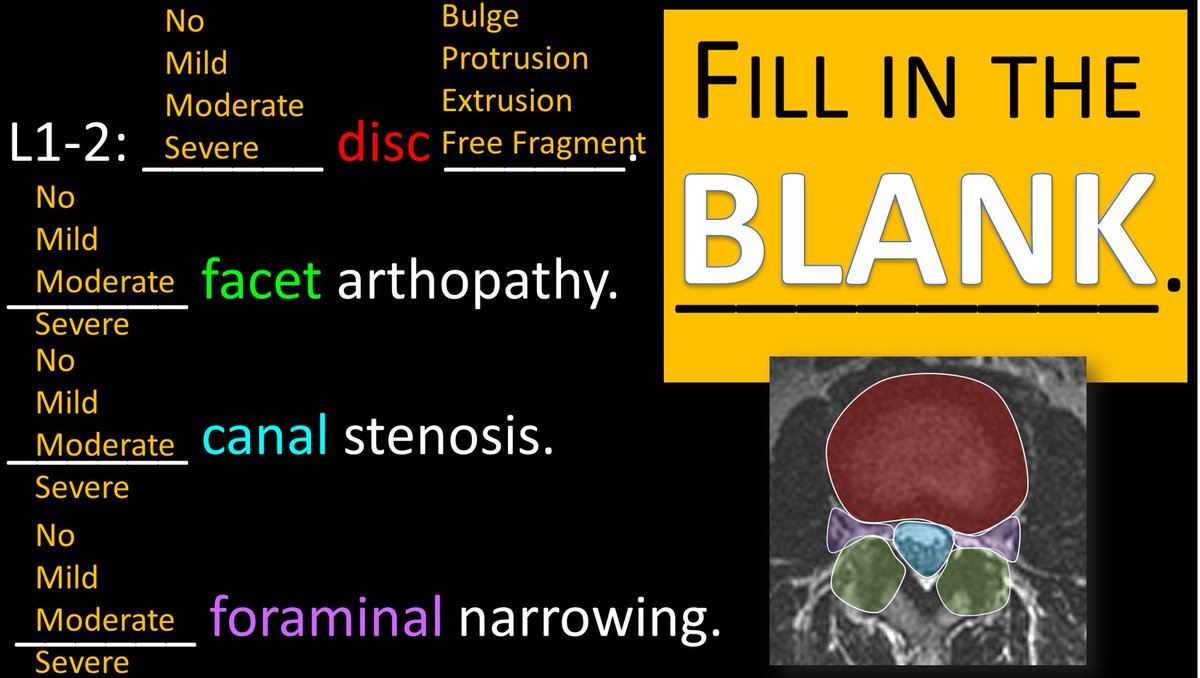1/Need help reading spine imaging? I’ve got your back! It’s as easy as ...