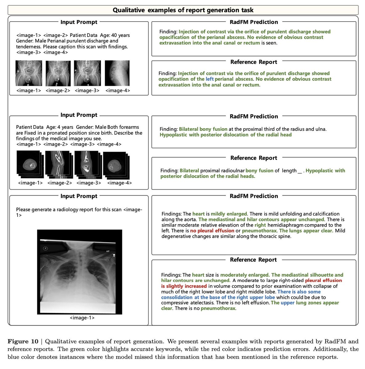 Purulent Fluid Color
