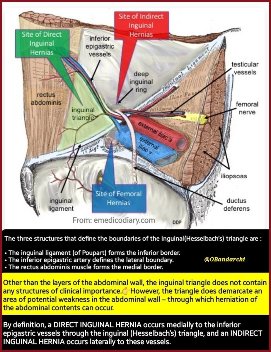 Hesselbach Triangle Femoral Triangle MEDizzy