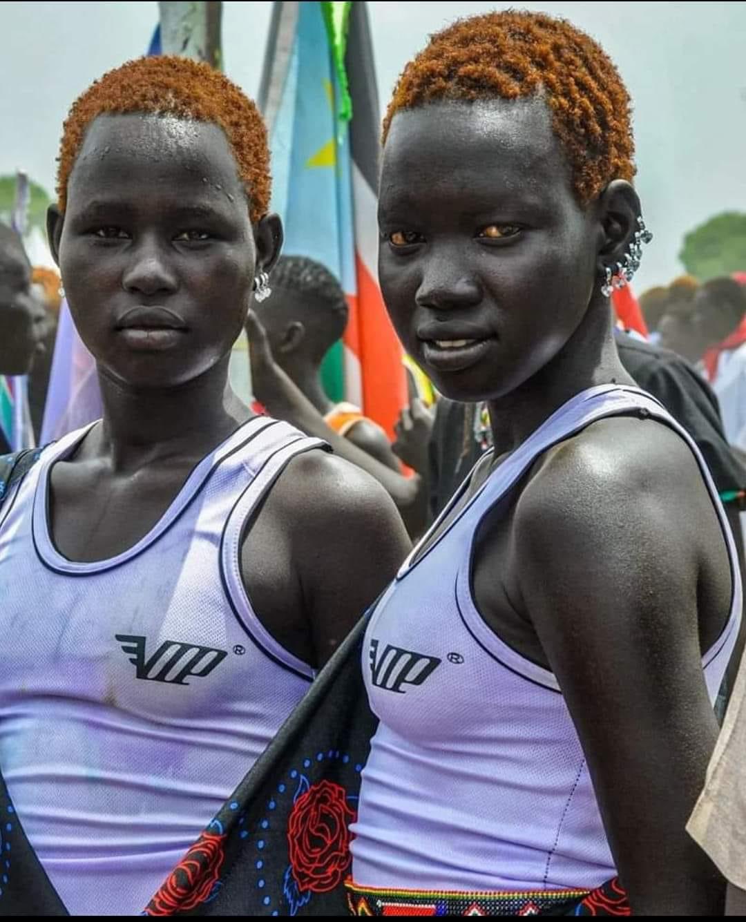 Most Beautiful South Sudan Girls Model Nyakim Gatwech Challenges