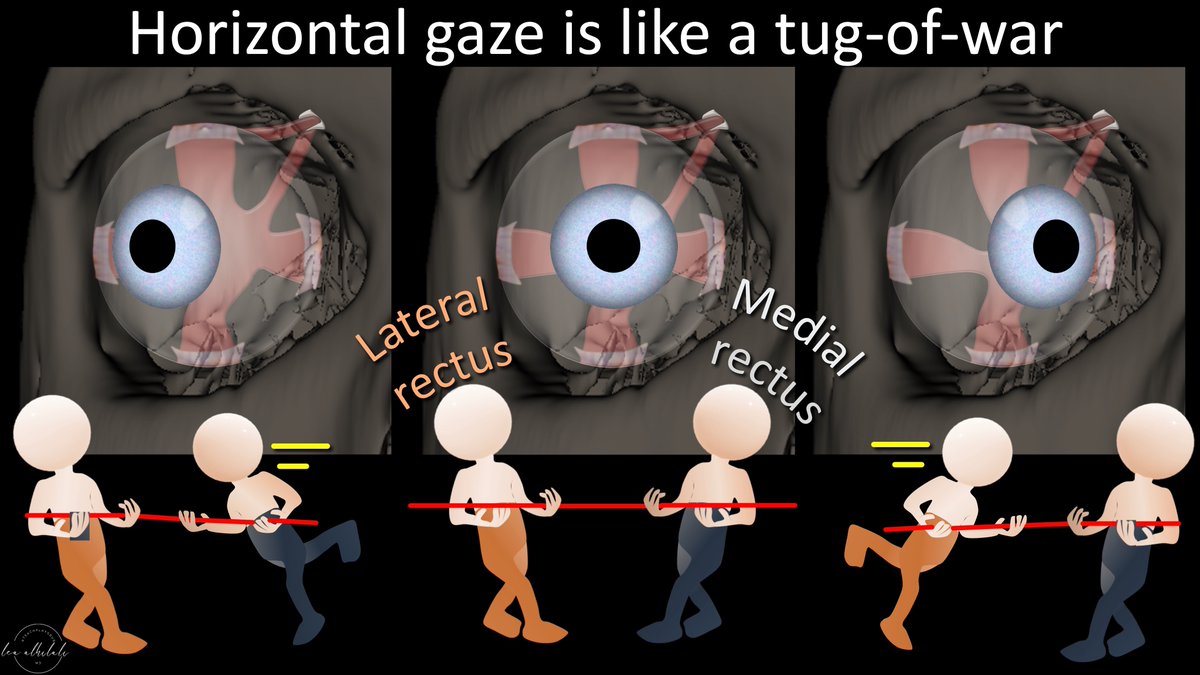1/Is trying to understand diplopia making you crossed-eyed?! When a ...