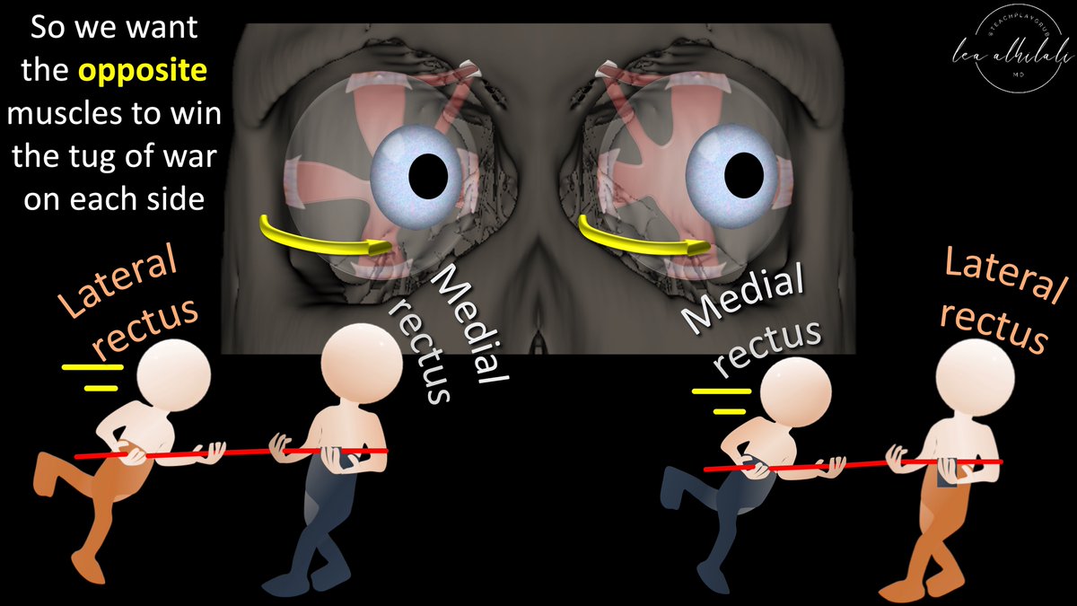 1/Is trying to understand diplopia making you crossed-eyed?! When a ...