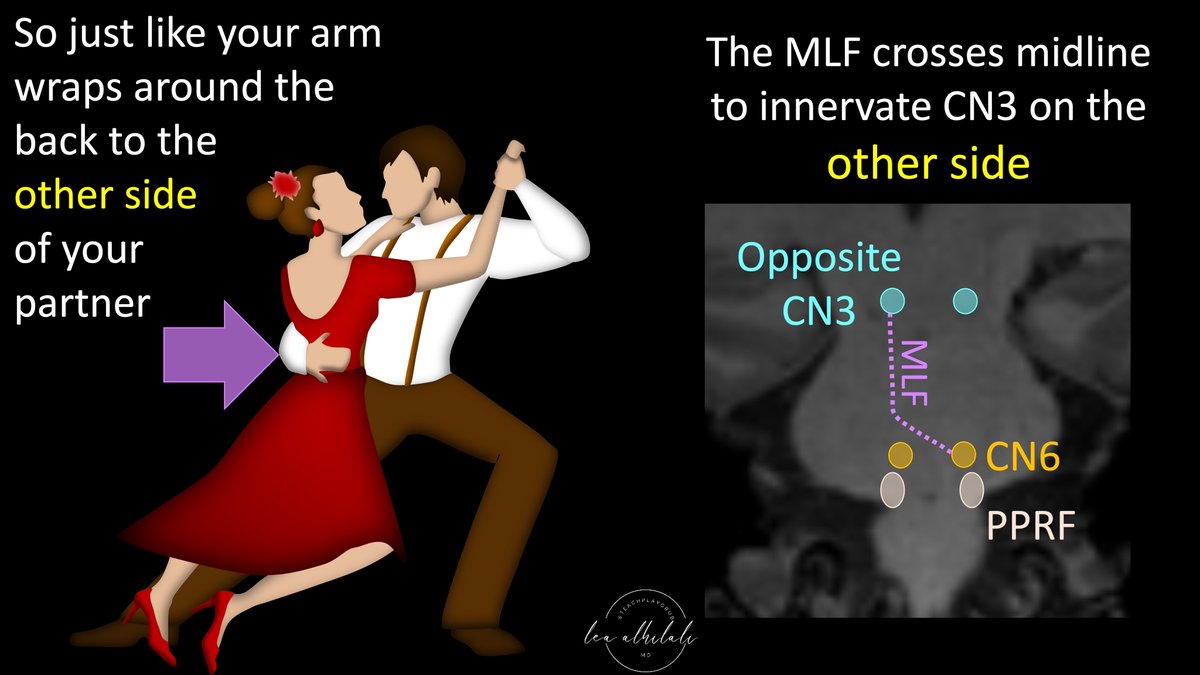 1/Is trying to understand diplopia making you crossed-eyed?! When a ...