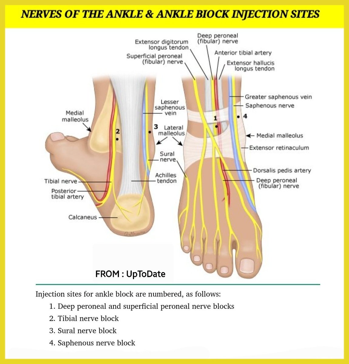 Superficial Peroneal Nerve Block