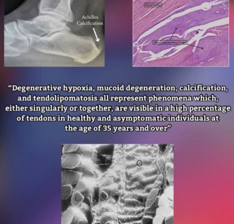 30 Tendon Concepts - Thread from Jake Tuura @jake_tuura - Rattibha