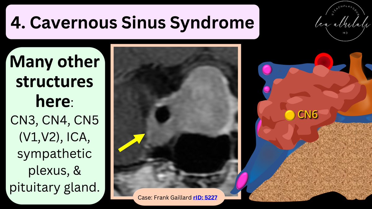 1/It’s rare a patient can tell exactly you where their pathology is—but ...