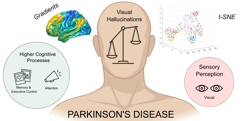 Visual Hallucinations