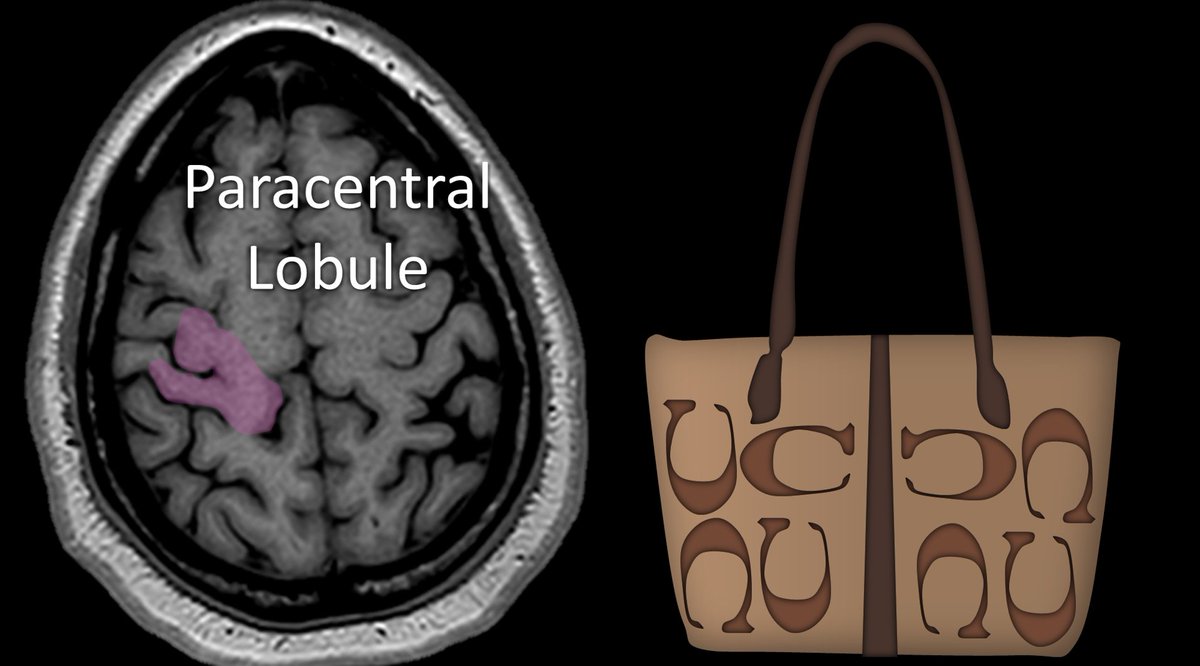 1/They say form follows function! Brain MRI anatomy is best understood ...