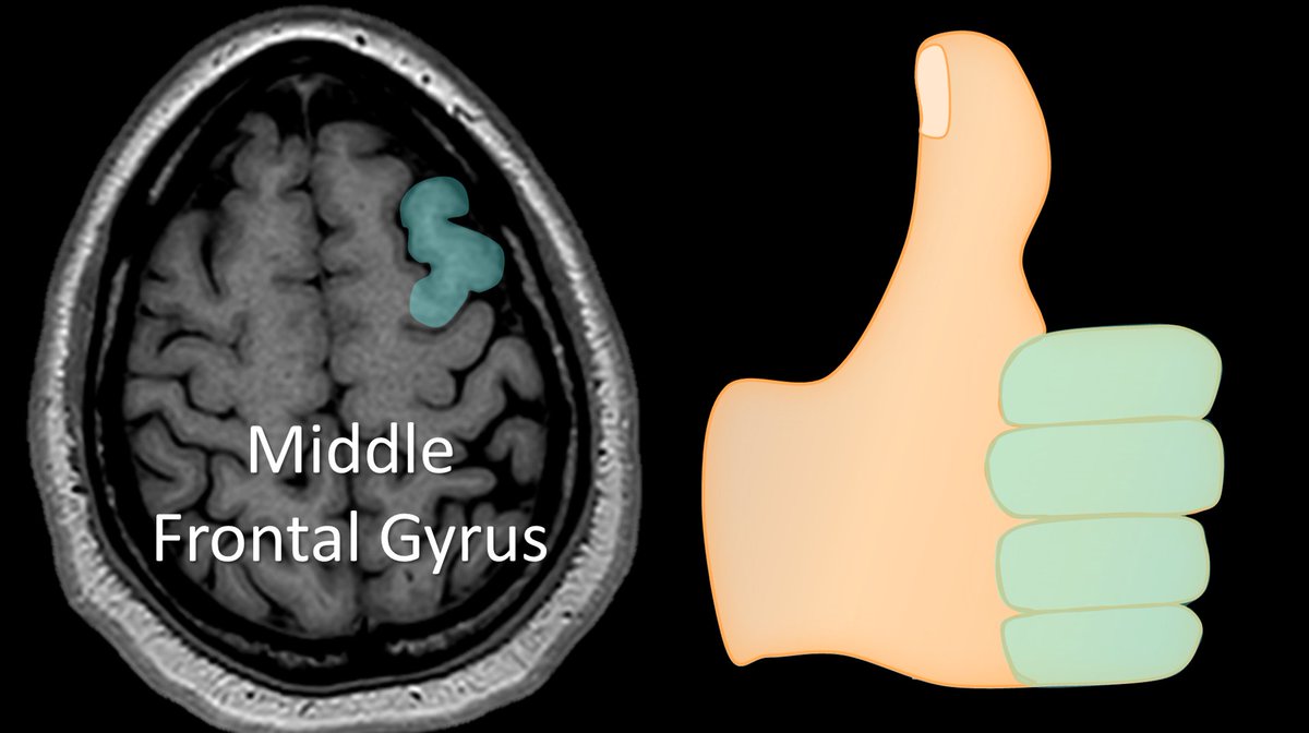 1/They say form follows function! Brain MRI anatomy is best understood ...