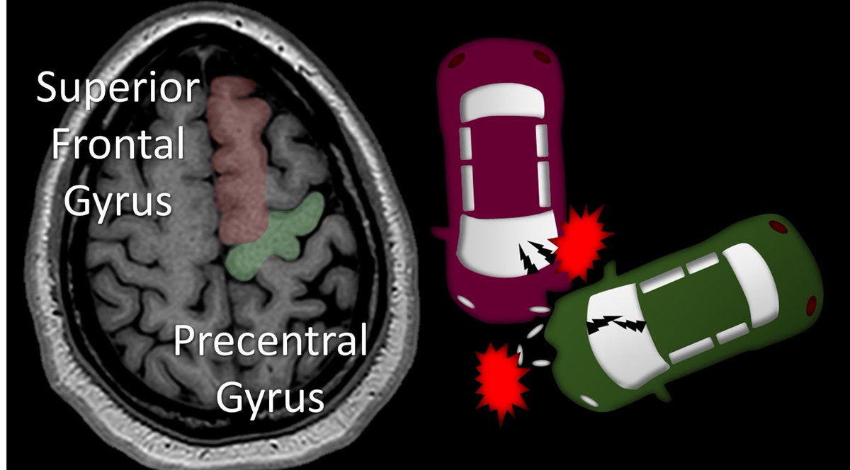 1/They say form follows function! Brain MRI anatomy is best understood ...