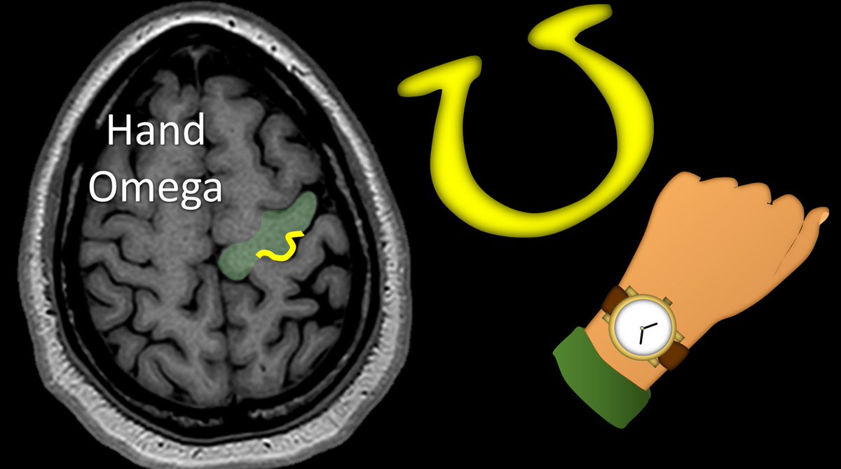 1/They say form follows function! Brain MRI anatomy is best understood ...