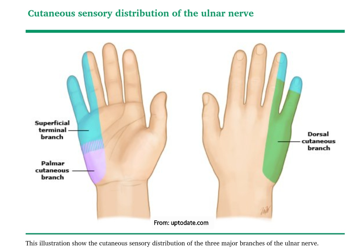 Ulnar Nerve Distribution Ulnar Nerve Anatomy Hand Clinics