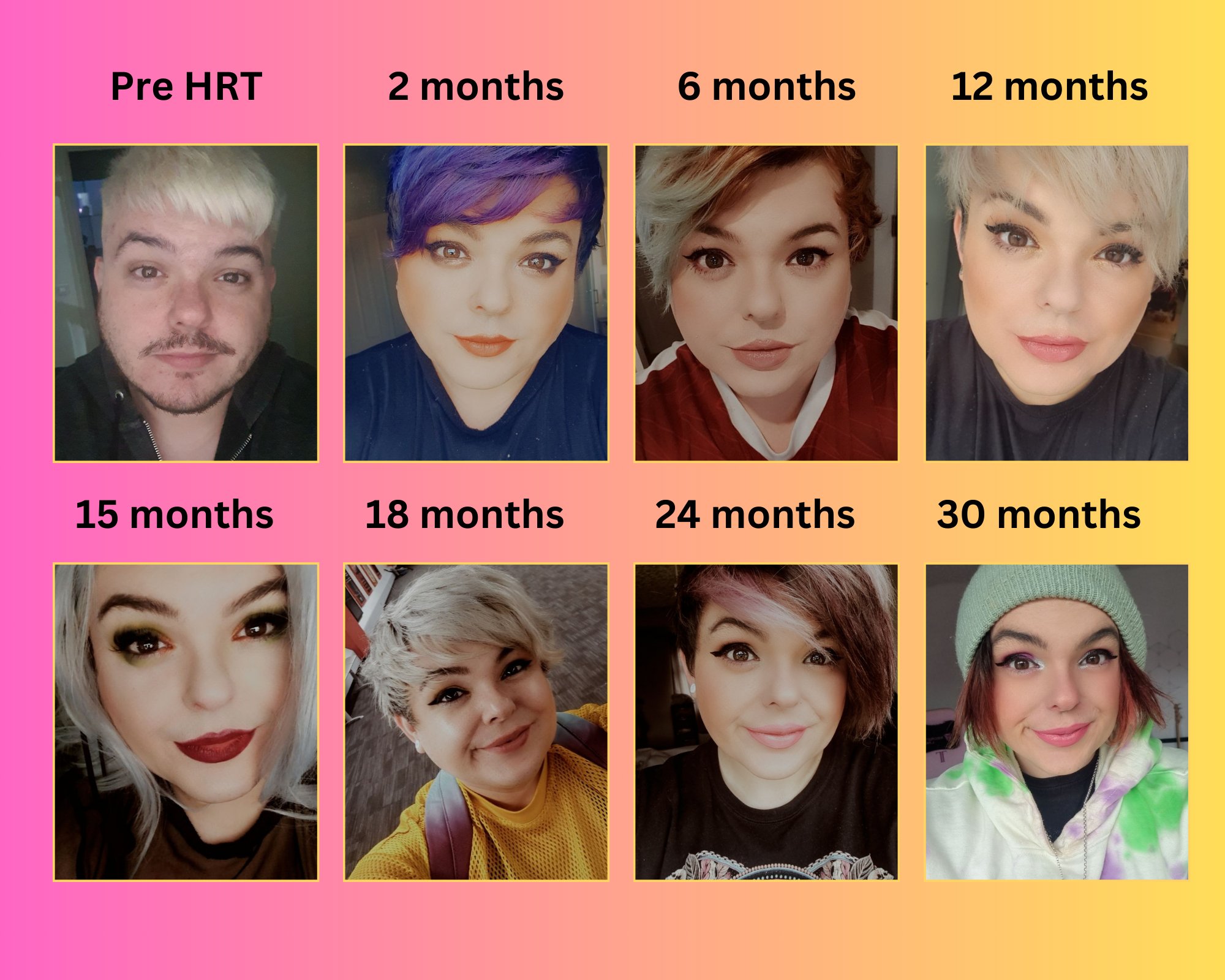 Estrogen Before And After