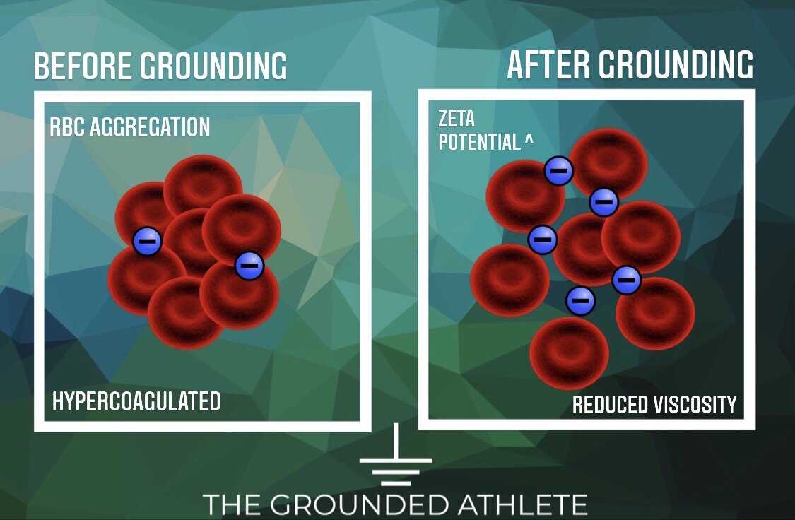 Cardiovascular Disease (CVD) is the #1 Killer in America Here are 5 ...