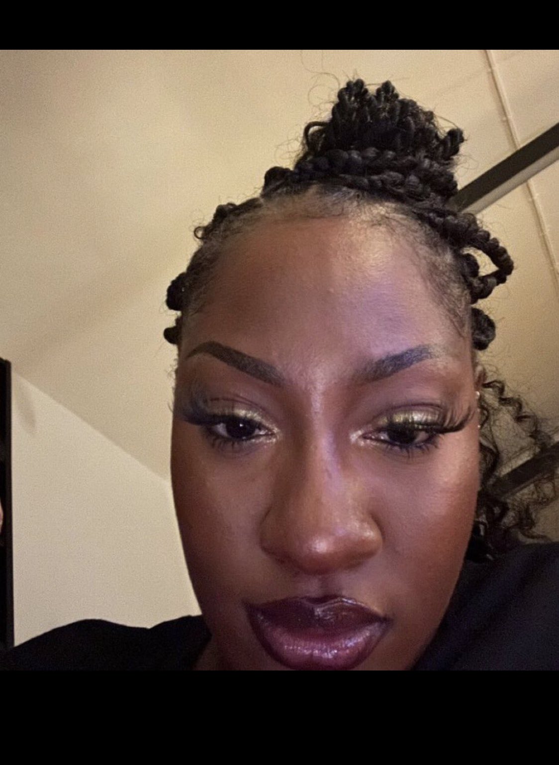 Pregnant Swollen Face