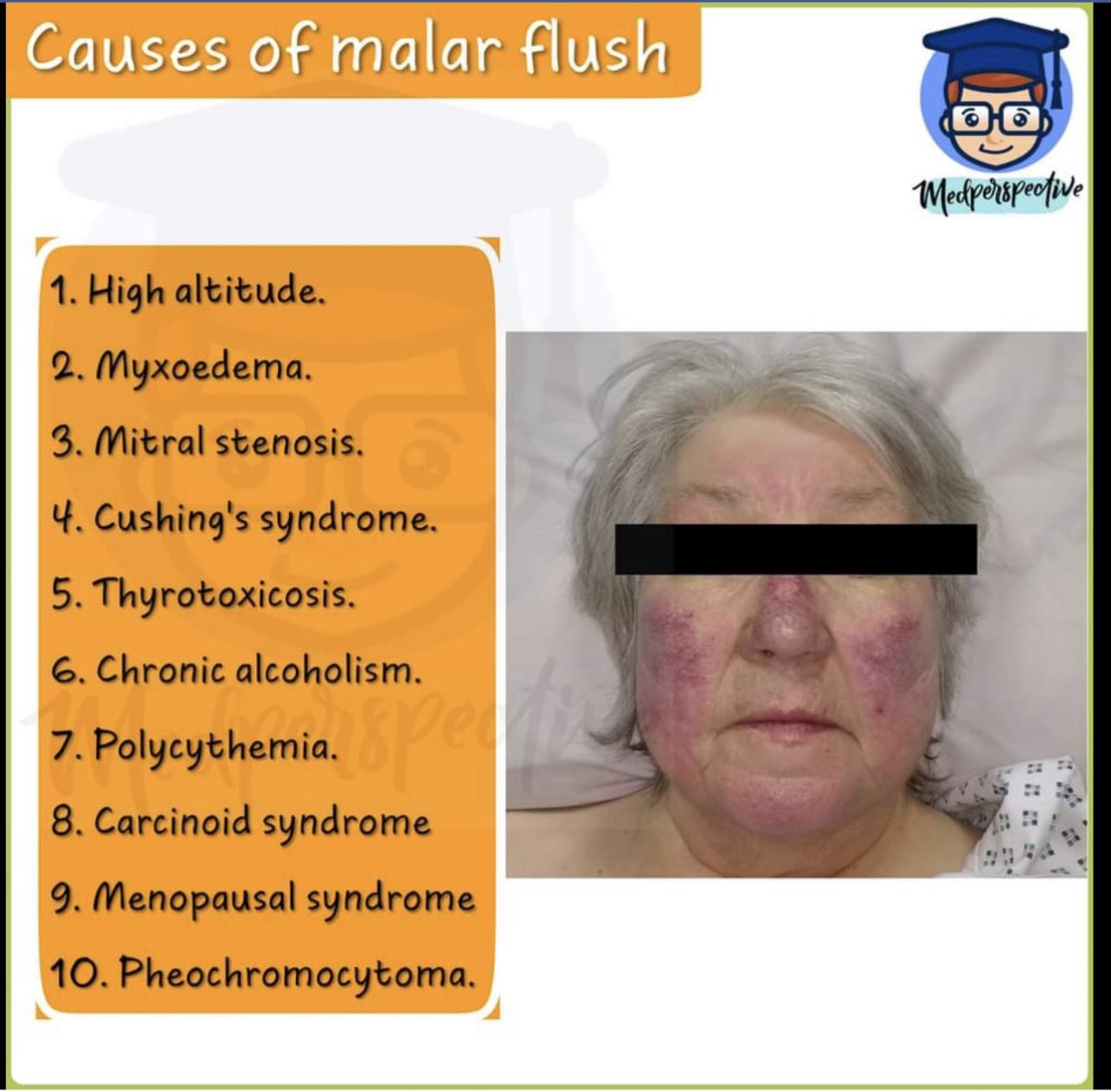 Lupus Malar Rash Characteristics Cutaneous Involvement In Systemic