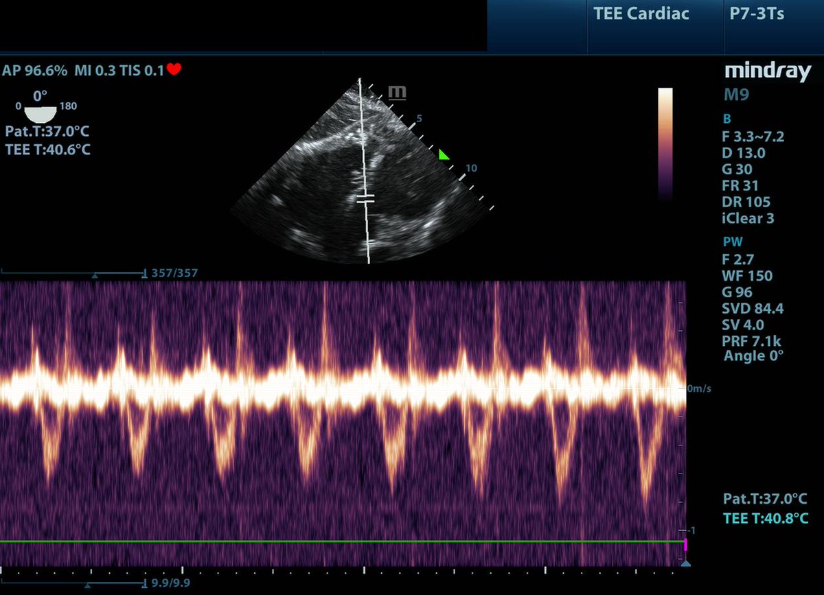 Ross Prager's Threads – Thread Reader App