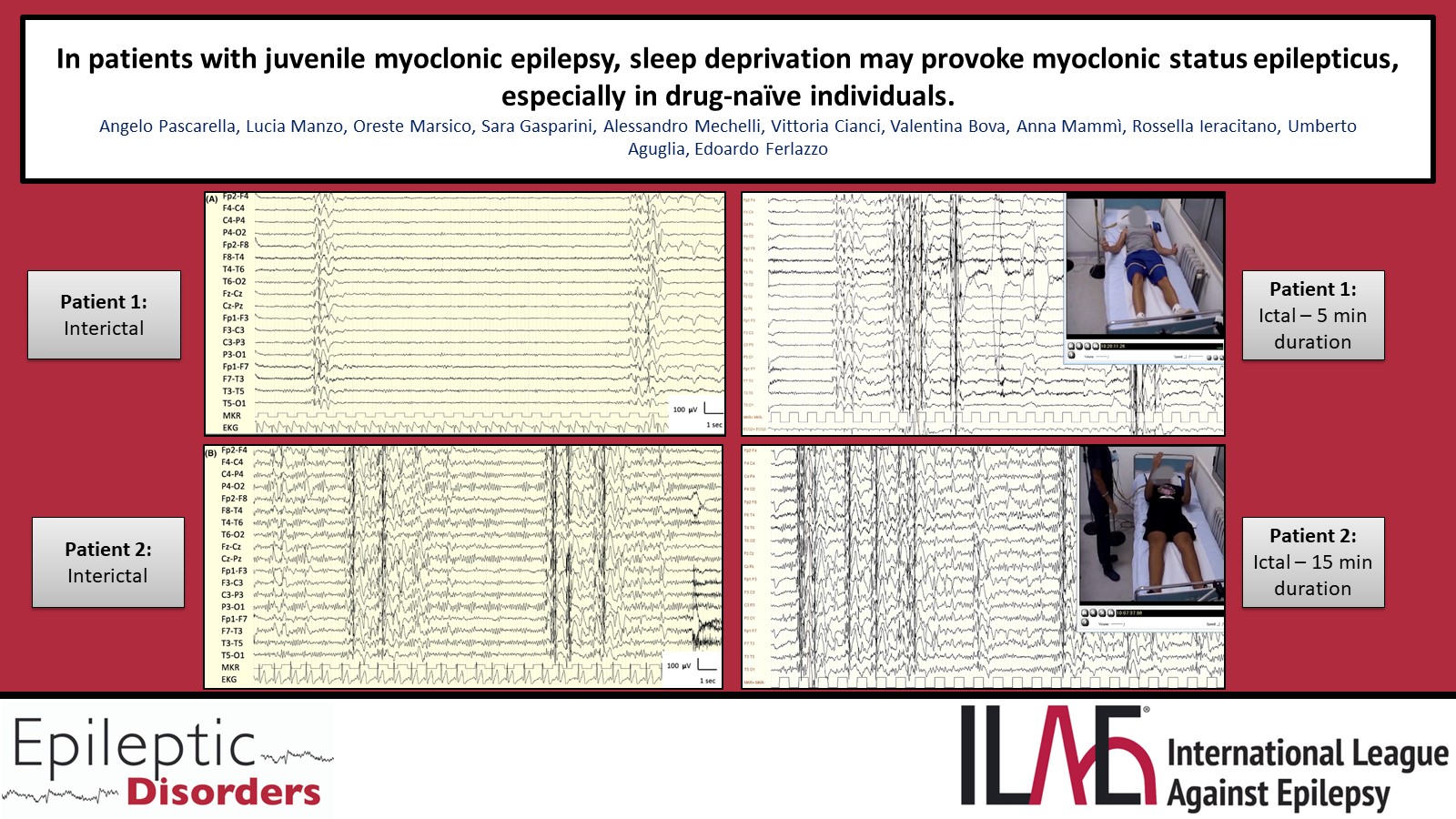 Juvenile Myoclonic Epilepsy Familial Adult Myoclonic Epilepsy: A New