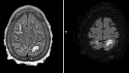 1/22 Hello #medtwitter #meded #FOAMed #neurotwitter #neurocritical # ...