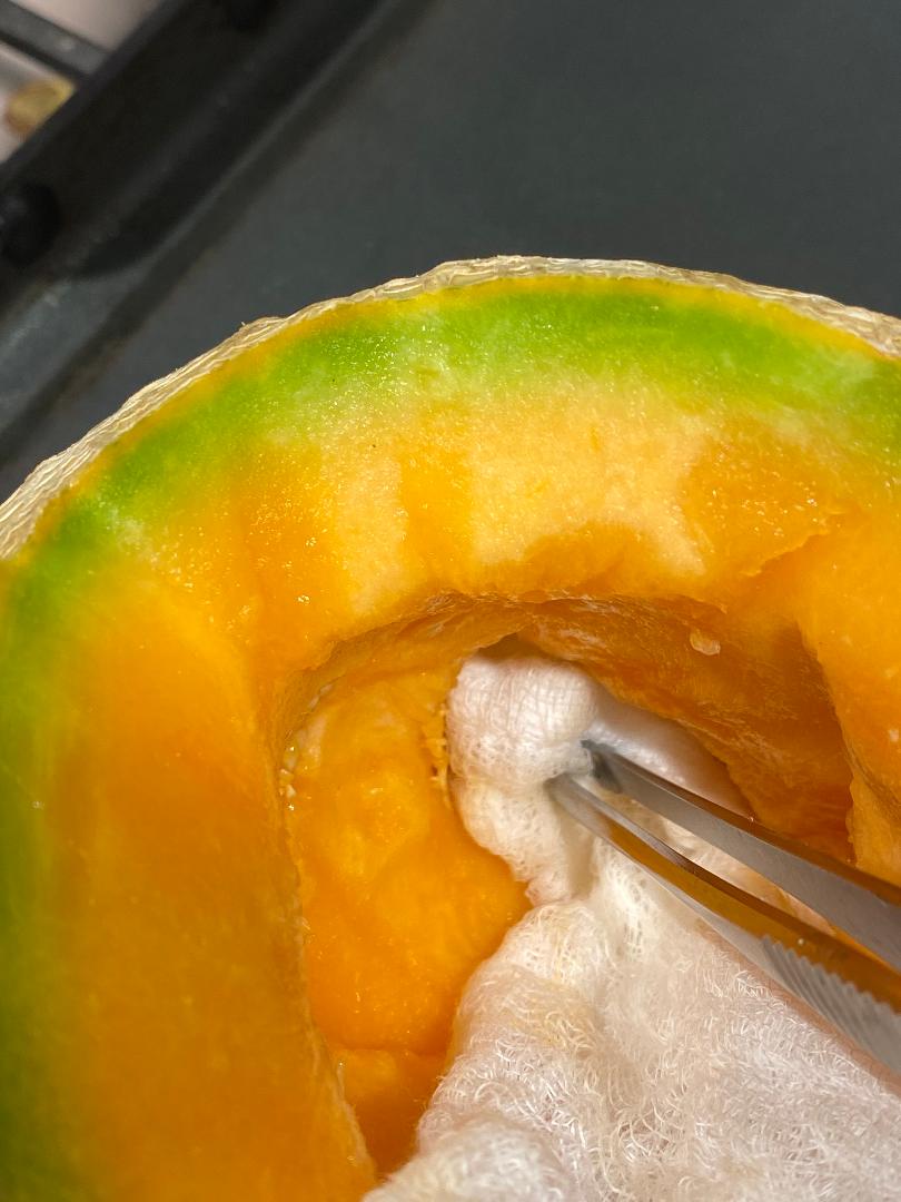 🧵regarding The Packing Of Cavities For Hemostasis During Surgery Here I Will Discuss Why Using