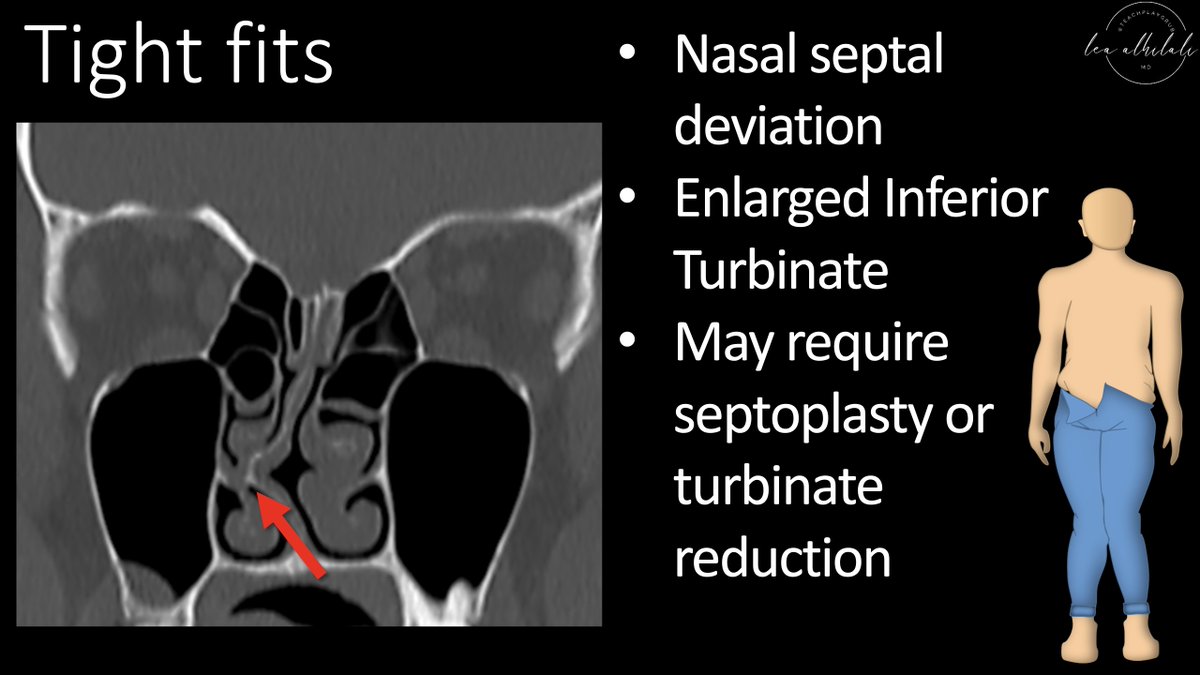 1/Time to FESS up! Do you understand functional endoscopic sinus ...