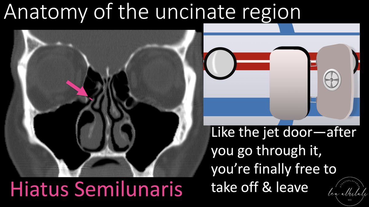 1/Time to FESS up! Do you understand functional endoscopic sinus ...