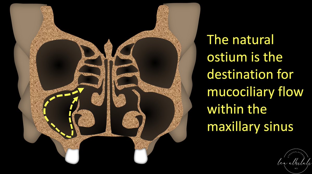 1/Time to FESS up! Do you understand functional endoscopic sinus ...