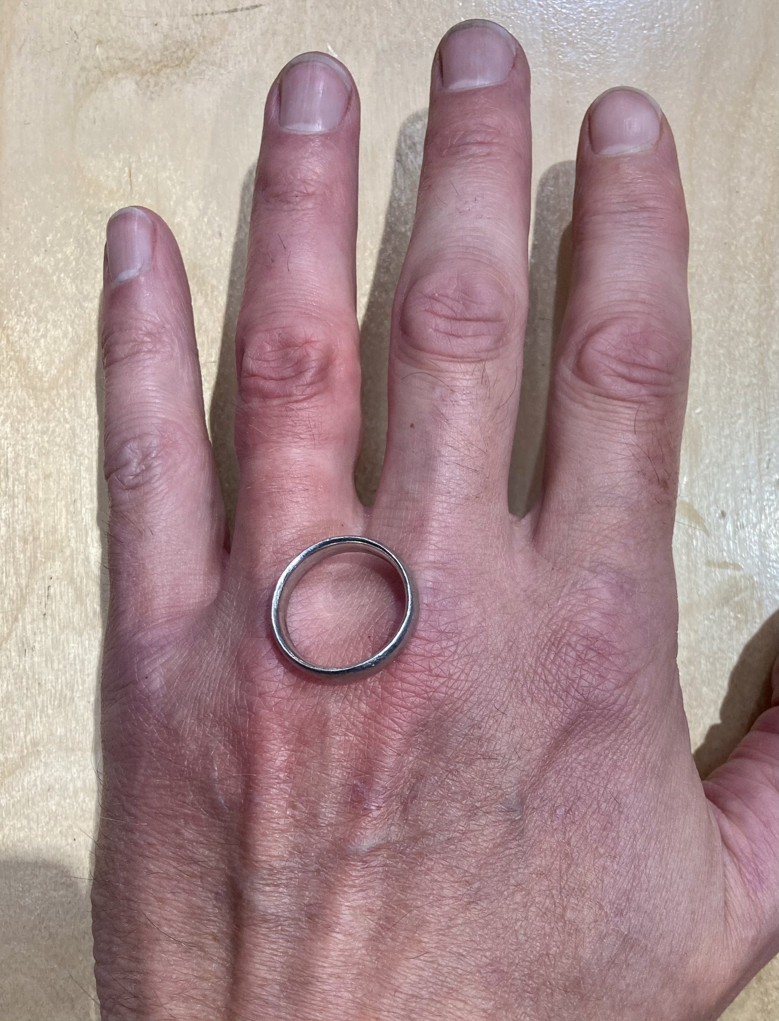 Wedding ring injuries 60 photos - Astyledwedding.com