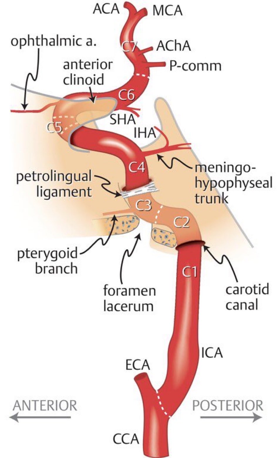 Internal Carotid Artery