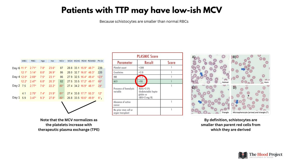 1/2 I tweeted a poll asking to identify the patient with TTP among 3 ...