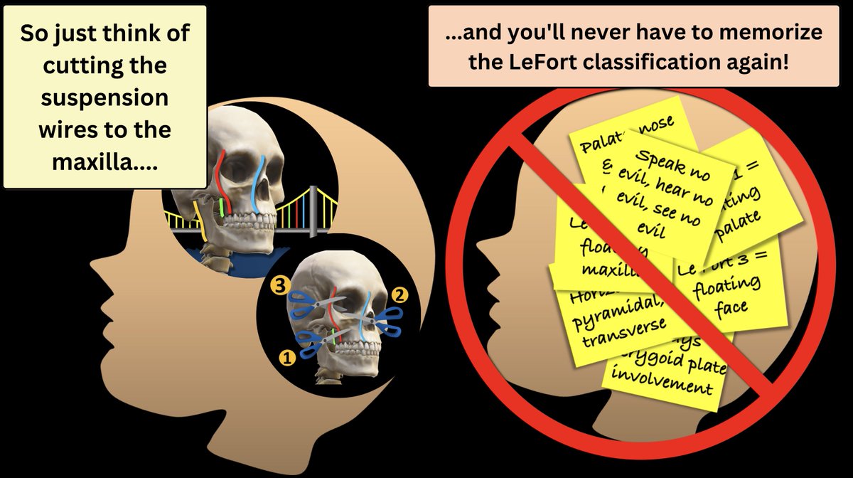 1/Feeling broken up when it comes to LeFort fractures? My fellows ...