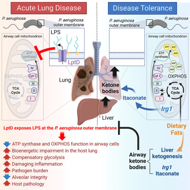 Pseudomonas Aeruginosa Lung Infection