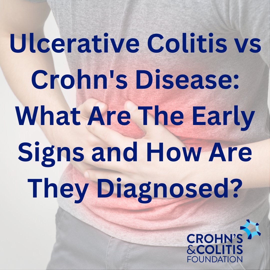 Ulcerative Colitis Mucus In Stool