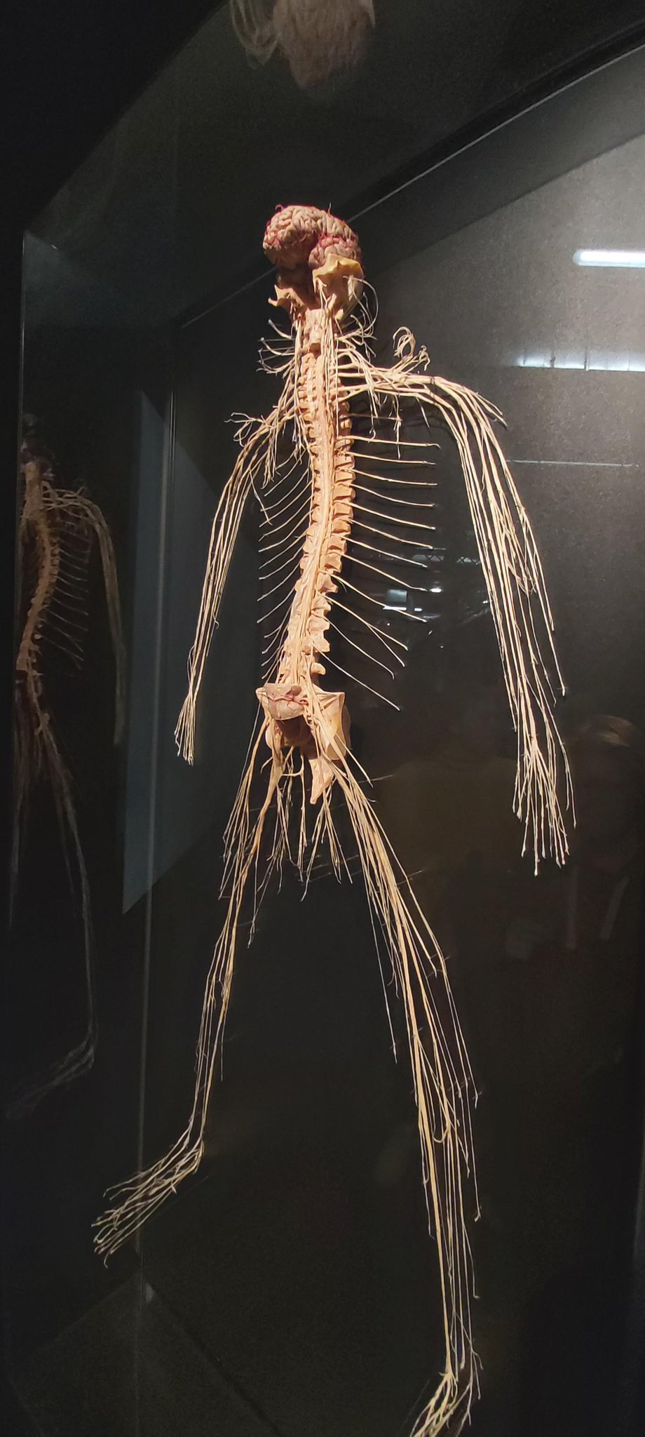 Real Human Nerves