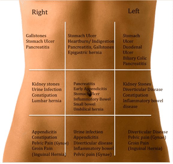 Referred Abdominal Pain Chart Referred Pain Patterns: Trunk And Thigh