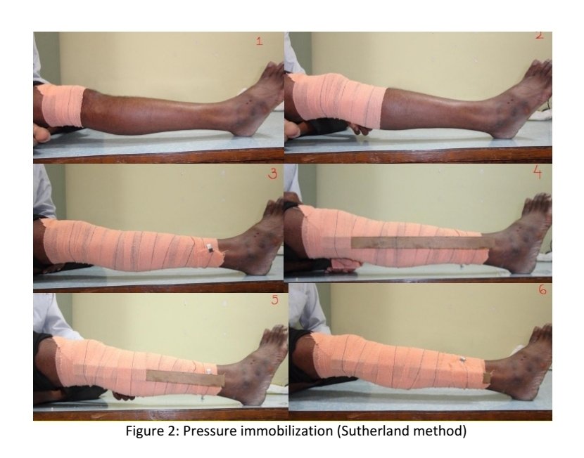 A 🧵 on FIRST AID in snakebite🐍 First a question ️ How important is ...