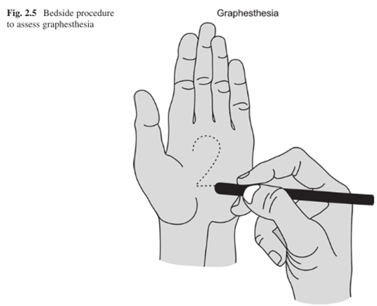 Corticobasal Syndrome (CBS): aliens among us 👽 Clinical symptoms and ...
