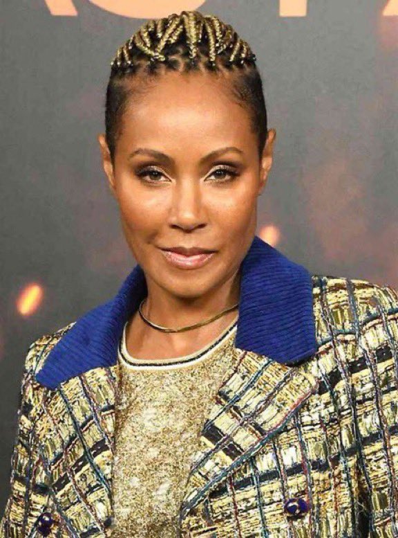 Jada Pinkett Smith Box Braids Alopecia Is No Laughing Matter For
