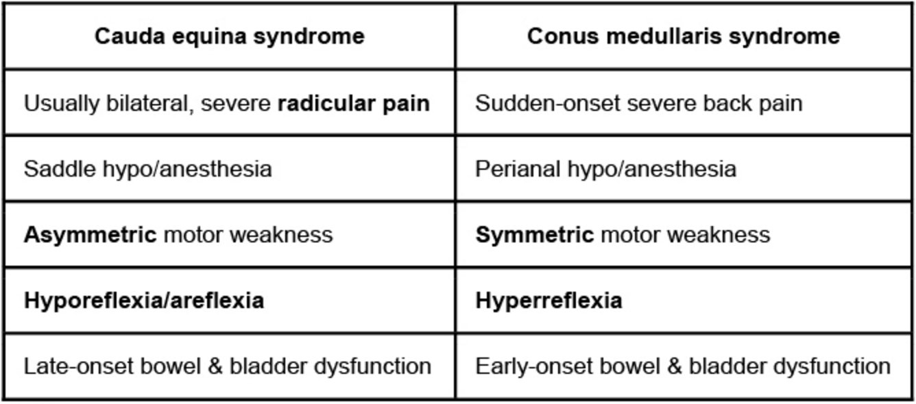 Ces Vs Cms Cauda Equina Syndrome Vs Conus Medullaris Syndrome
