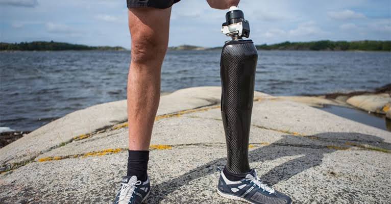 Artificial Limbs Nasa