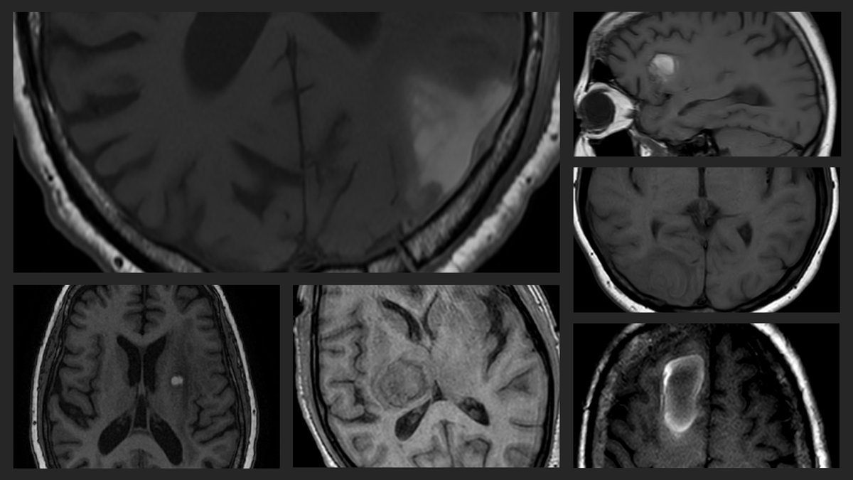 1/Asking “How old are you?” can be dicey—both in real life & on MRI! Do ...